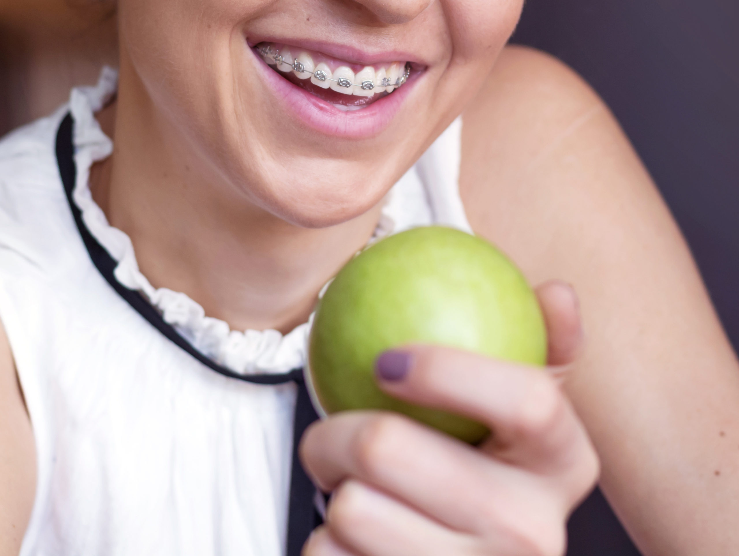 Comer con brackets: Principales preguntas y sus respuestas - Clínica ...